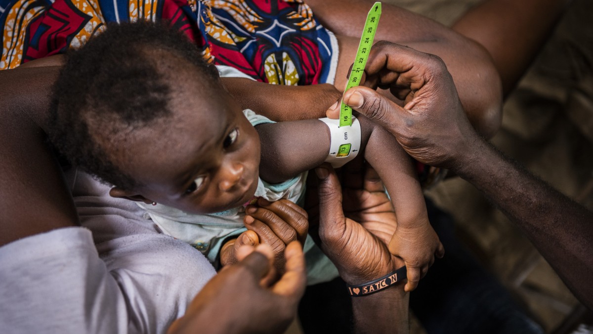 Malnutrition now 'a major global public health threat' | Concern Worldwide