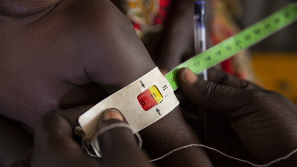 Reversing the rising levels of hunger and starvation | Concern Worldwide