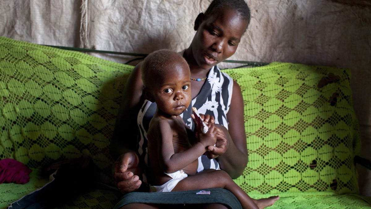 What is stunting? | Concern Worldwide