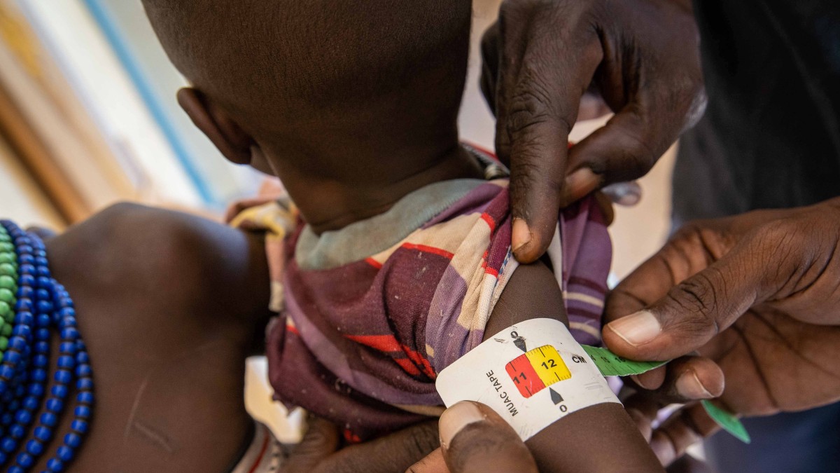 What are the effects of hunger? | Concern Worldwide